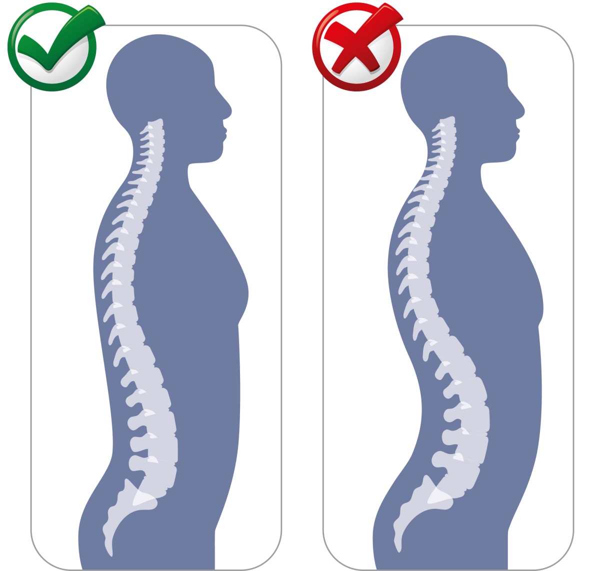 ¿Qué es y cómo prevenir la hiperlordosis lumbar? - Con S de Sport